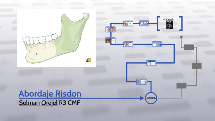 Abordaje Risdon by Selman Orejel on Prezi