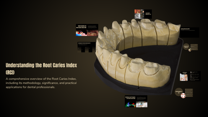 Understanding the Root Caries Index (RCI) by T H on Prezi