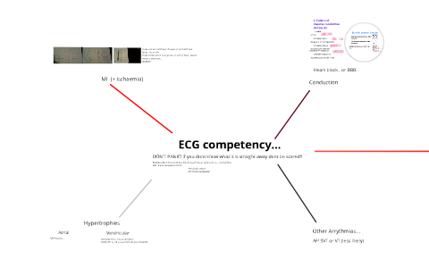 ECG competency by luke mclennan on Prezi