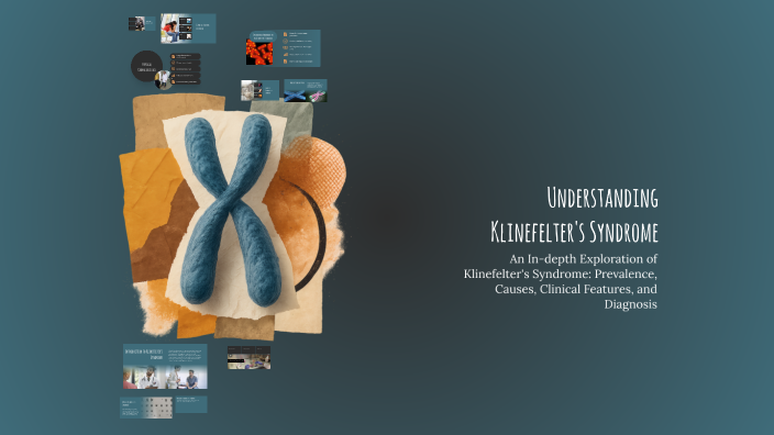 Understanding Klinefelter's Syndrome by mohsen اميثق on Prezi