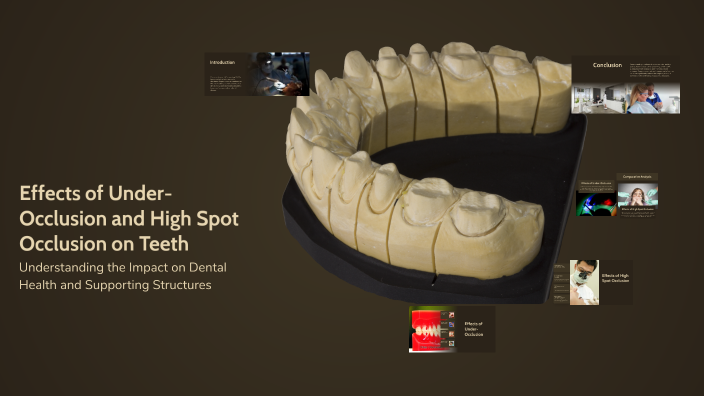 Effects of Under-Occlusion and High Spot Occlusion on Teeth by mohamed ...
