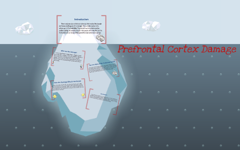 Prefrontal Cortex Damage by anna shearer on Prezi