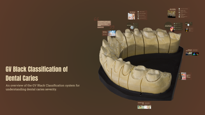 GV Black Classification of Dental Caries by Amr Hussam Mohamed Mahmoud ...