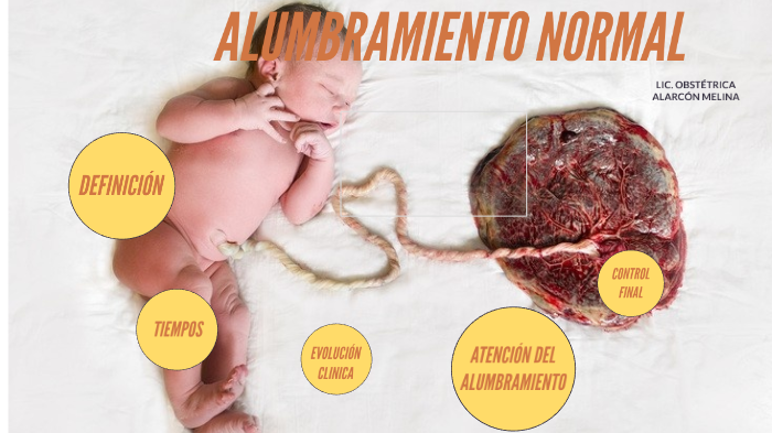 ALUMBRAMIENTO NORMAL by Melina Alarcón on Prezi