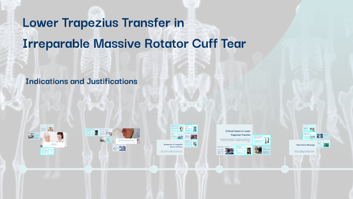 Lower Trapezius Transfer in Irreparable Massive Rotator Cuff Tear by ...