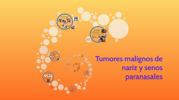 Tumores malignos de nariz y senos paranasales by jessica Guzmán on Prezi