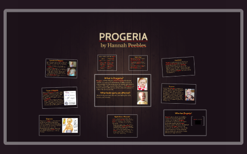 Progeria by Hannah Peebles on Prezi