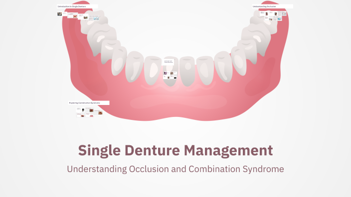 Single Denture Management by عبدربه عمار on Prezi
