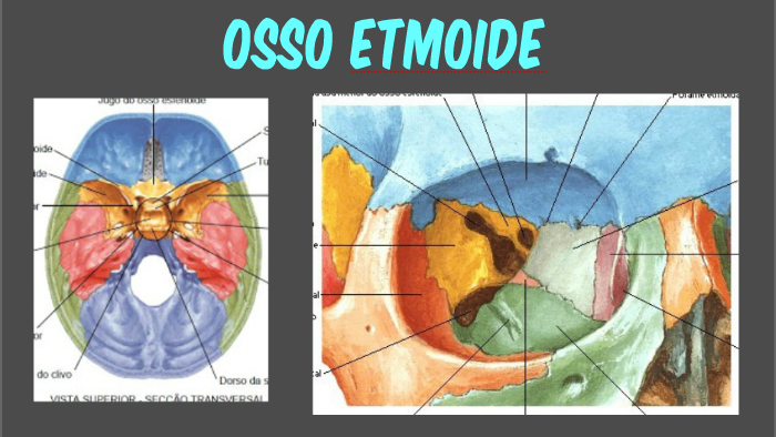 OSSO ETMOIDE by Eugenia Diomedi on Prezi