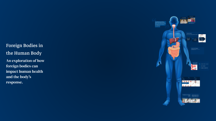 Foreign Bodies in the Human Body by daniel Jurkiewicz on Prezi