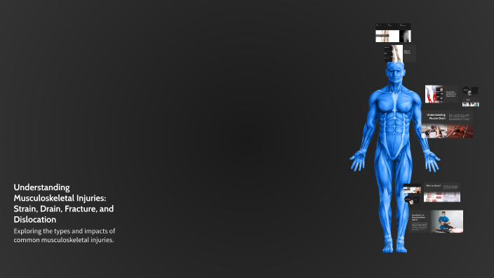 Understanding Musculoskeletal Injuries: Strain, Drain, Fracture, and ...