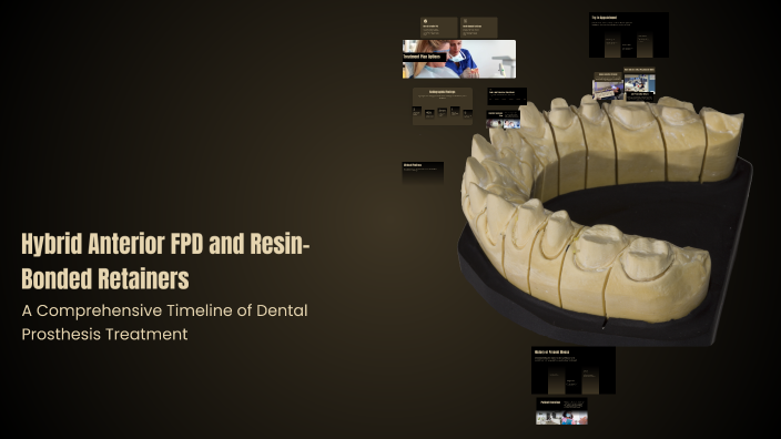 Hybrid Anterior FPD and Resin-Bonded Retainers by Nicolette Beatenbough ...