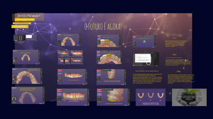 exocad aula 1 coroa /coping by Luis Andrade on Prezi