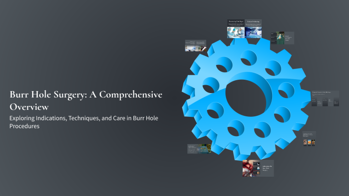 Burr Hole Surgery: A Comprehensive Overview by Muhammad Addin on Prezi