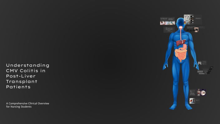 Understanding CMV Colitis in Post-Liver Transplant Patients by ...