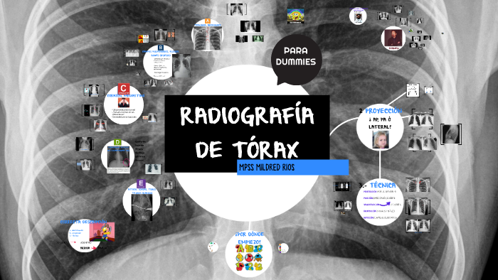RADIOGRAFIA DE TÓRAX by Mildred Rios on Prezi