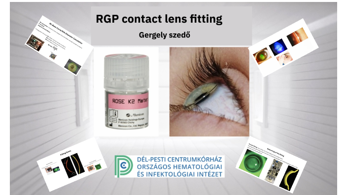RGP contact lens fitting by Gergő Szedő on Prezi