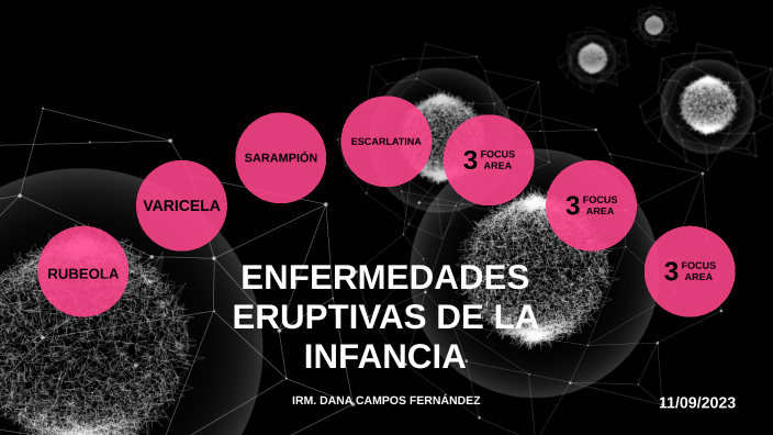 ENFERMEDADES ERUPTIVAS DE LA INFANCIA by Dana Gabriela Campos Fernandez ...