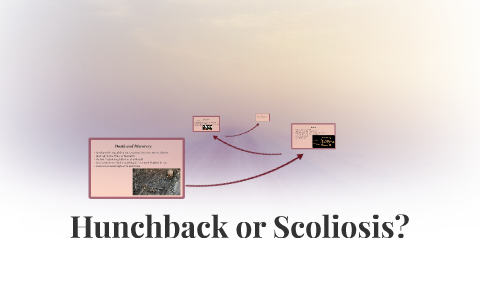 Hunchback or Scoliosis? -King Richard III by Brittany Pape on Prezi
