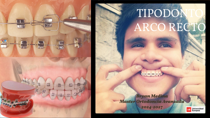 TIPODONTO ARCO RECTO by Bryan Medina on Prezi