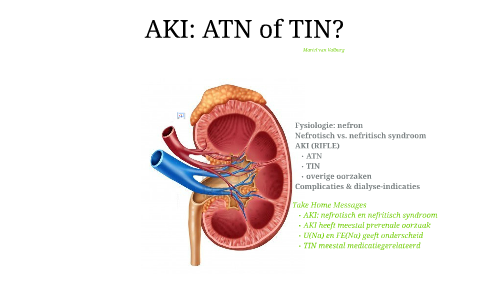 AKI: ATN of TIN? by Mariel van Valburg on Prezi