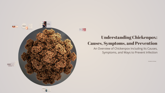 Understanding Chickenpox: Causes, Symptoms, and Prevention by Usha ...