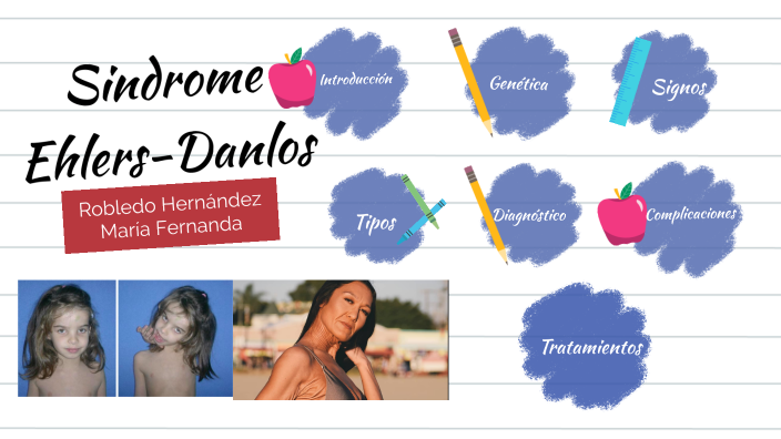 Sindrome Ehlers- Danlos_Maria Fernanda Robledo Hernández by María ...