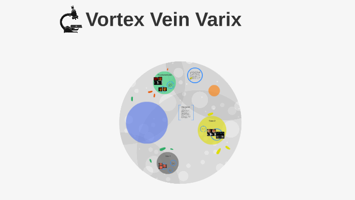 Vortex Vein Varix by Ruchi Shah on Prezi