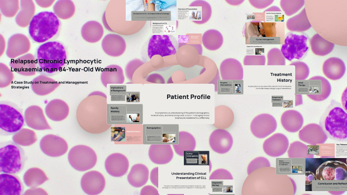 Relapsed Chronic Lymphocytic Leukaemia in an 84-Year-Old Woman by Ranga Rodrigo on Prezi