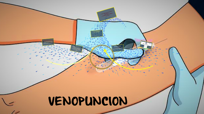 VENOPUNCION by carlos alexander tibavija martinez on Prezi