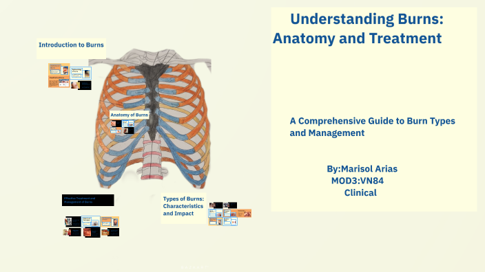 Understanding Burns: Anatomy and Treatment by sandra sandrA on Prezi