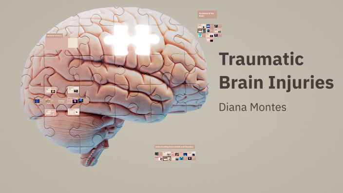 The Complex Human Brain by Diana Montes on Prezi
