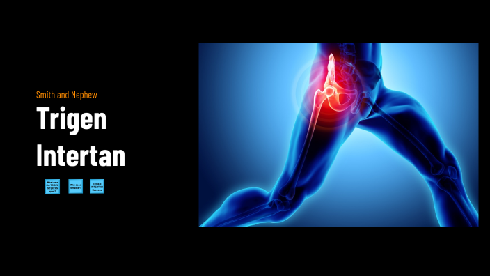 Trigen Intertan by austin schlagel on Prezi