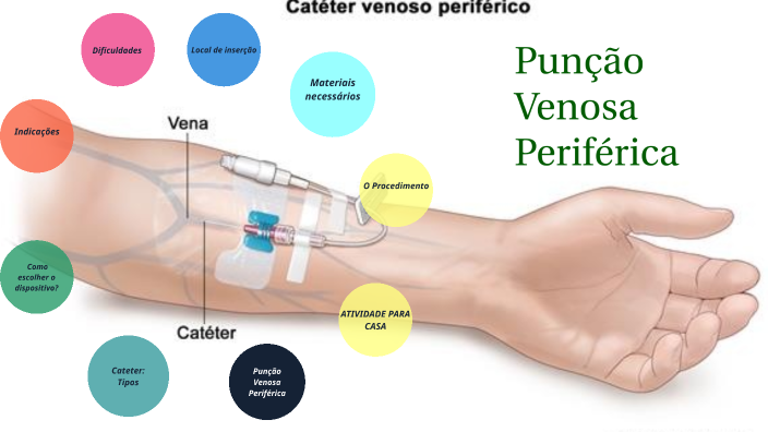 Acessos Venosos Part2 by Alexandre Santos Silva on Prezi