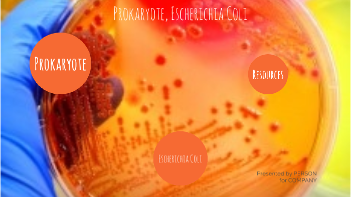 Prokaryote, Escherichia Coli by Madison L. Laster on Prezi