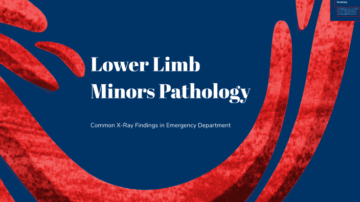 Lower Limb Minors Pathology by Thomas Boyd on Prezi