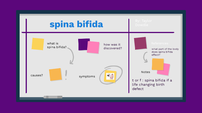 Spina Bifida by taylor dowdle on Prezi