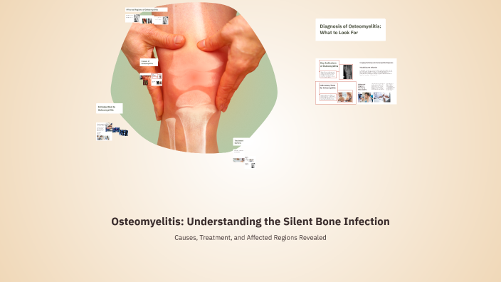 Osteomyelitis: Understanding the Silent Bone Infection by SRIRAMBABU I ...