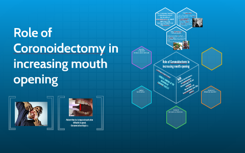 Role of coronoidectomy in by Jannela Rivera on Prezi