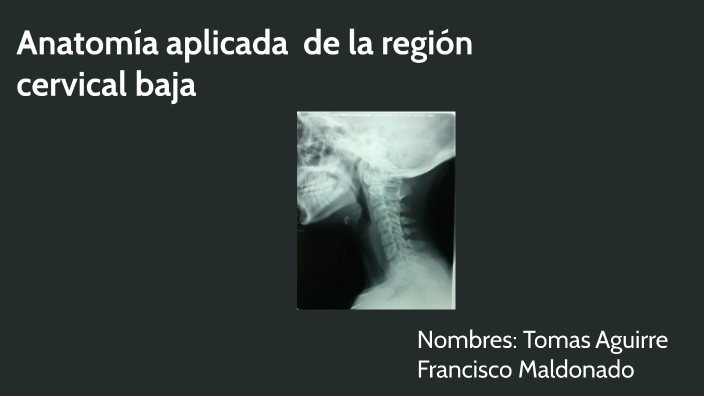 cervical baja by Francisco Maldonado on Prezi