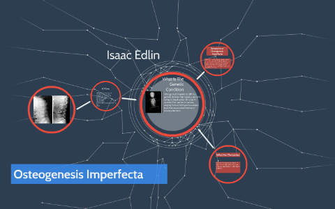 Osteogenesis Imperfecta by isaac edlin