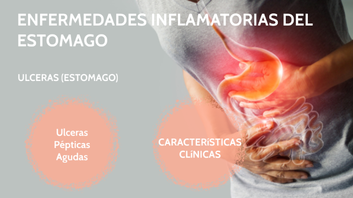 ULCERAS (ESTOMAGO) by Darianny Pérez on Prezi
