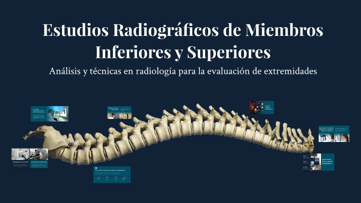 Estudios Radiográficos de Miembros Inferiores y Superiores by Luisa ...