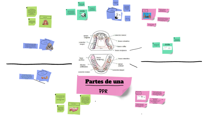 Partes de una protesis parcial removible (PPR) by fivij82024@wuzak.com ...