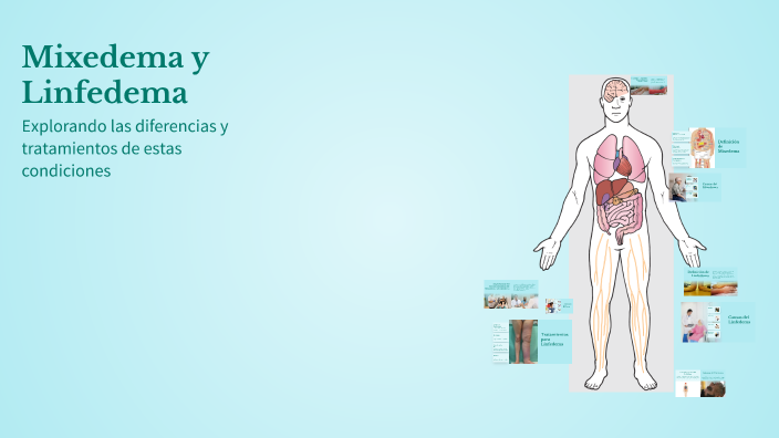 Mixedema y Linfedema by Edwin Solano on Prezi