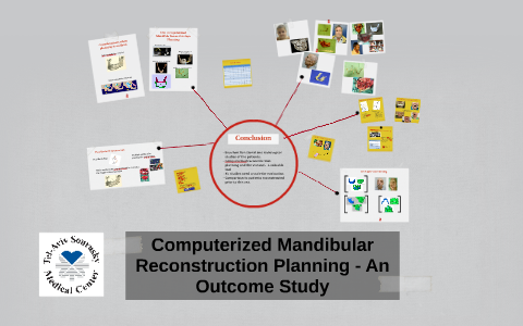 Computerized Mandibular Reconstruction. Is It Really Better by Ravit ...