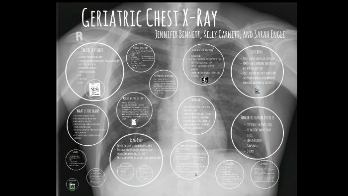Geriatric Chest X-Ray by Kelly Carnett on Prezi