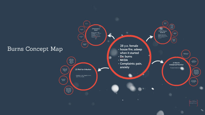Burns Concept Map by Maija Archibeque on Prezi Burns Concept Map by Maija Archibeque on Prezi