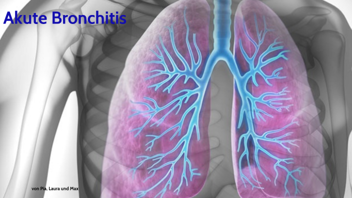 akute Bronchitis by Max Gabler on Prezi