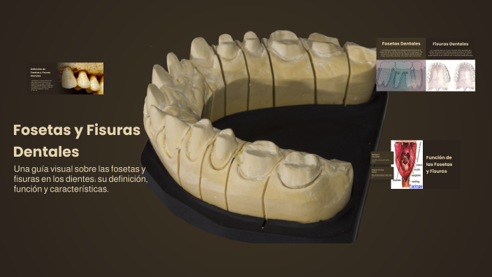 Fosetas y Fisuras Dentales by gio mende on Prezi